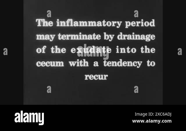 USA - 1929 - Animation is used to depict an appendix in its beginning ...