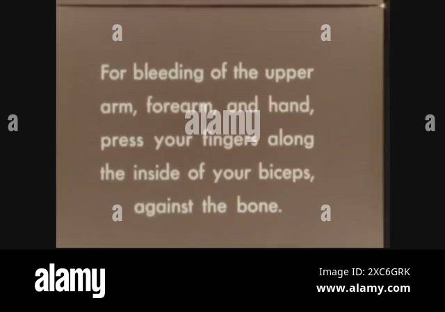 Severe bleeding first aid Stock Videos & Footage - HD and 4K Video ...