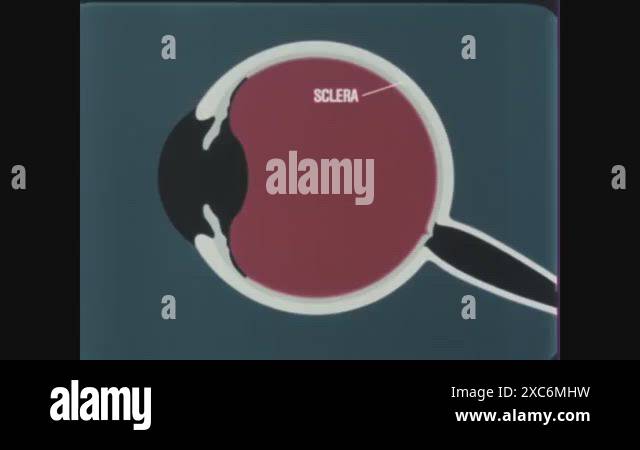 USA - 1981 - Animation is used to depict the different components of ...