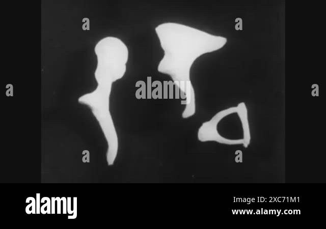 1949 - A size comparison between the head of a pin and the bones of the ... 1949 - A size comparison between the head of a pin and the bones of the ...
