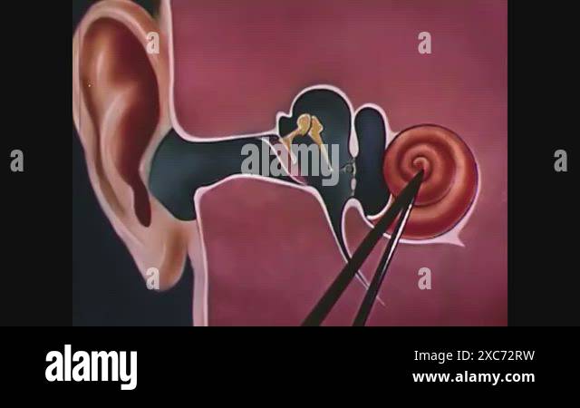 1949 - Partial animation is used to show how the human brain processes ...