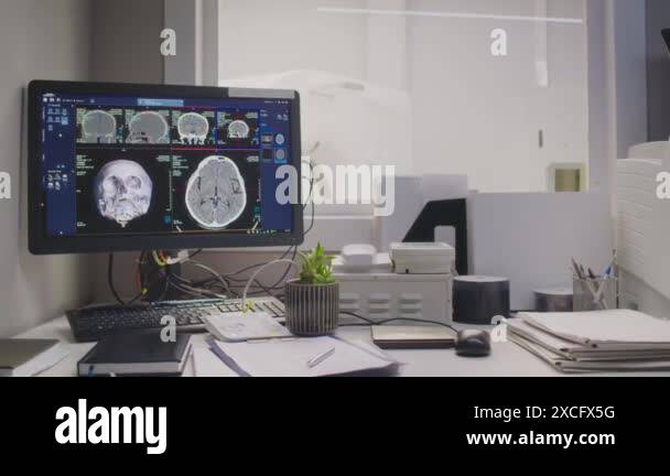 Functional mri scan Stock Videos & Footage - HD and 4K Video Clips - Alamy