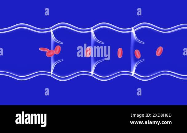 Anatomical 3d animation of an incompetent diseased vein. Valves ...