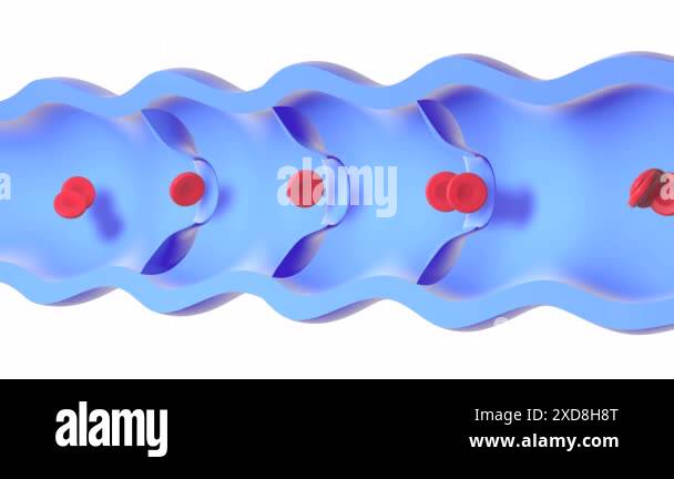 Anatomical 3d animation of a diseased and incompetent vein. Valves ...