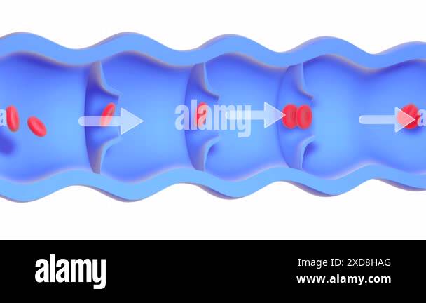 Anatomical 3d animation of a diseased and incompetent vein. Valves ...