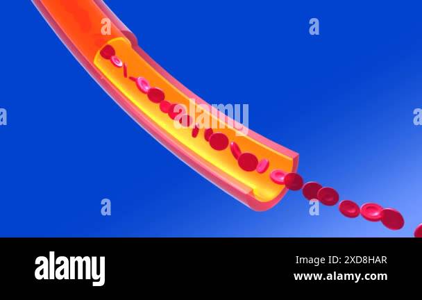 Anatomical 3D animation of artery with fat stuck to the walls. Circular ...