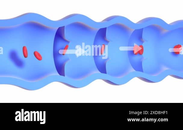 Anatomical 3d animation of a diseased and incompetent vein. Valves ...