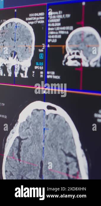 No people vertical close-up of digital head MRI Scan displayed on ...