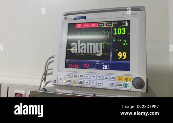 Vitals sign chart medical Stock Videos & Footage - HD and 4K Video ...