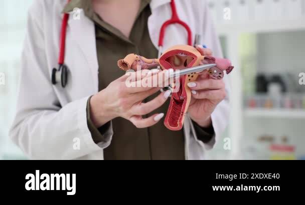 Gynecologist shows parts of women reproductive system on plastic model ...