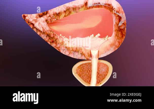Cross section of the urinary bladder Stock Videos & Footage - HD and 4K ...