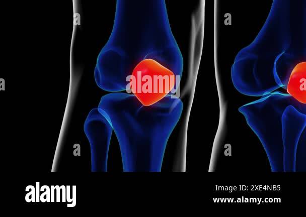 Patella bone anatomy Stock Videos & Footage - HD and 4K Video Clips - Alamy