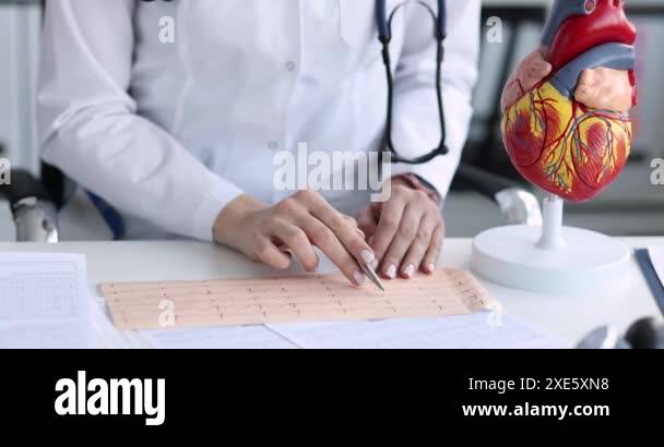 Heart rhythm and conduction disorders Stock Videos & Footage - HD and ...