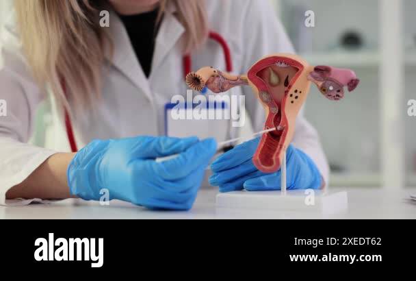 Physician shows process of collecting material from uterus. Doctor ...