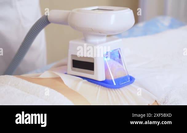 Subcutaneous adipose tissue Stock Videos & Footage - HD and 4K Video ...