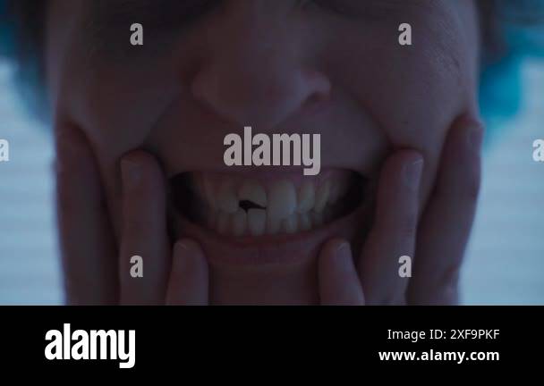 Injured woman with broken tooth crying in hospital clothes in emergency ...