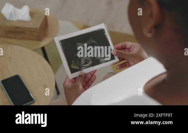 Ultrasound images of fetal Stock Videos & Footage - HD and 4K Video ...