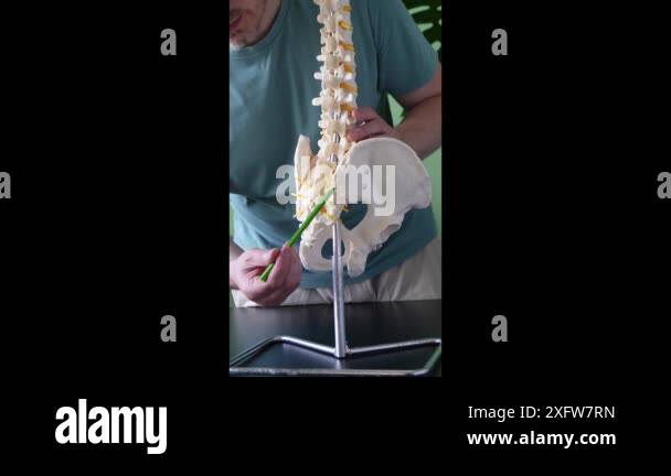 A medical professional uses a spine model to explain the anatomy and ...