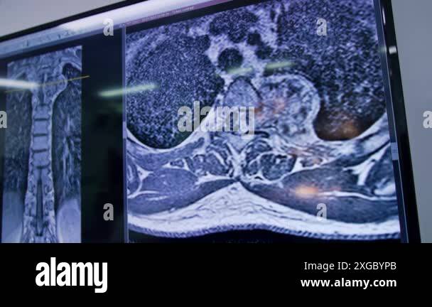 Human organs and systems on the MRI scan. Close up. Unrecognized doctor ...