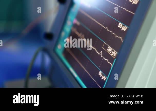 Nerve room Stock Videos & Footage - HD and 4K Video Clips - Alamy