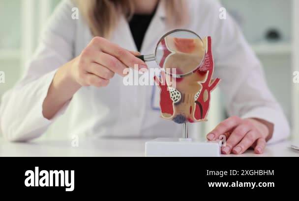 Female doctor uses magnifying glass to check hemorrhoid on rectum model ...