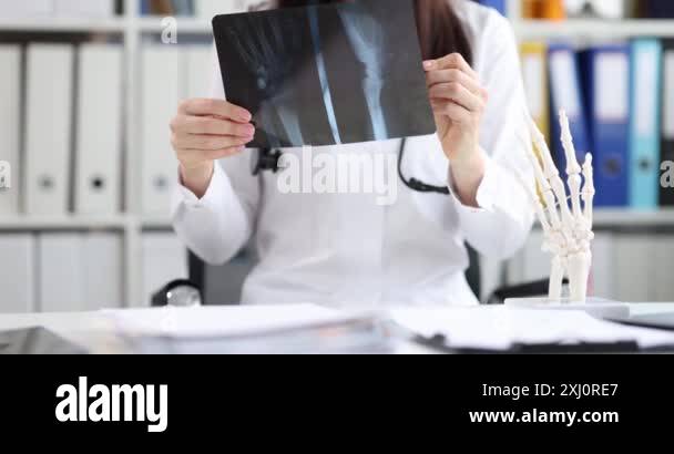 Traumatologist examines x-ray of hands and model of hand. Hand sprain ...