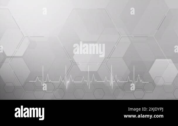 Medical concept with cardiogram and grid grey background. Loop ...