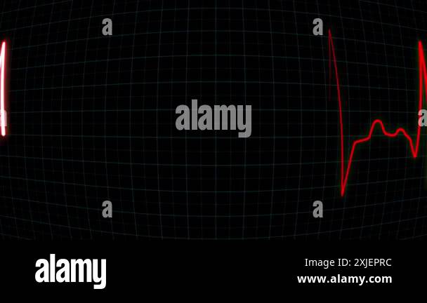 EKG heart beat line monitor. ECG flatline, screen of electrocardiogram ...