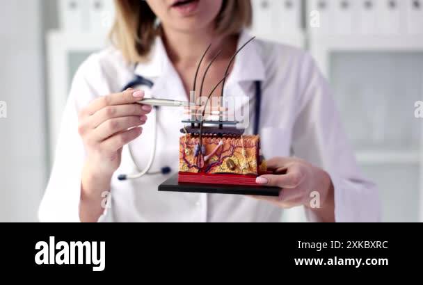 Dermatologist in medical uniform shows structure of hair follicle under ...