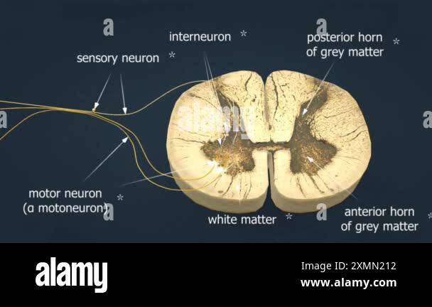 The withdrawal reflex, also known as the nociceptive flexion reflex or ...