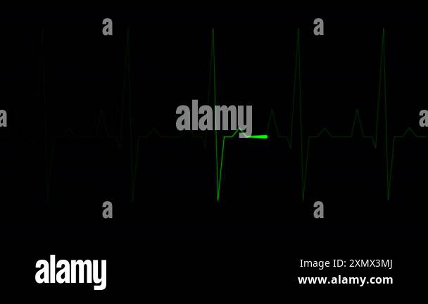 Green heart pulse graphic line. Cardiogram cardiography oscilloscope ...