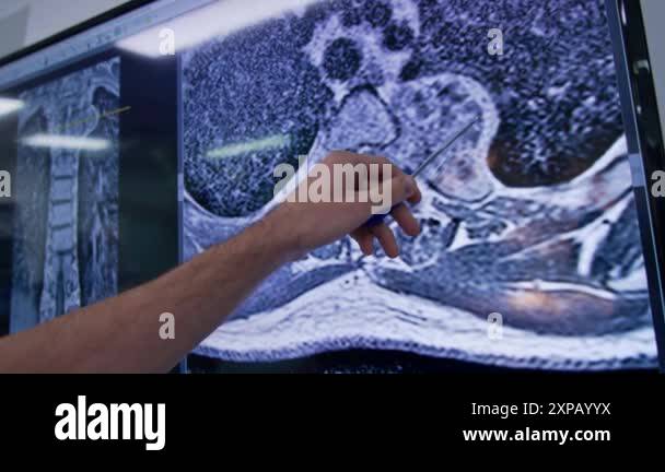 Male doctor's hand using a pen to point at the problematic zones on the ...