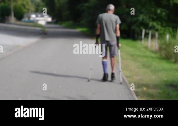 man with broken left leg in modern blue fiberglass plaster cast with ...