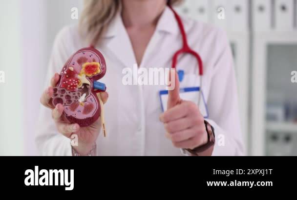 Doctor artificial kidney model and thumbs up. Successful approved ...