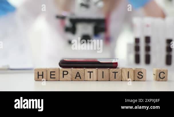 Hepatitis C and test tube with blood in laboratory. Viral liver disease ...
