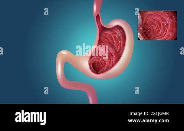 2D animation. Gastric mucosa. Digestive endoscopy or gastroscopy ...