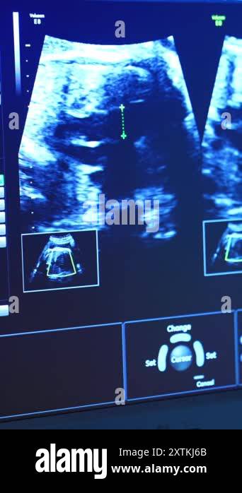 3d scan ultrasound Stock Videos & Footage - HD and 4K Video Clips - Alamy
