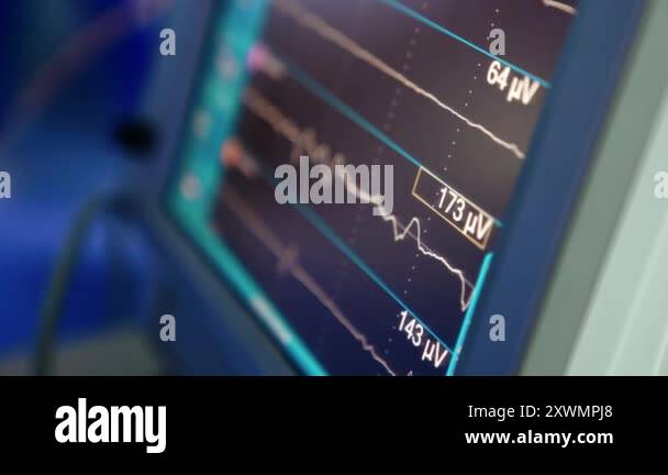 Top view medical equipment Stock Videos & Footage - HD and 4K Video ...