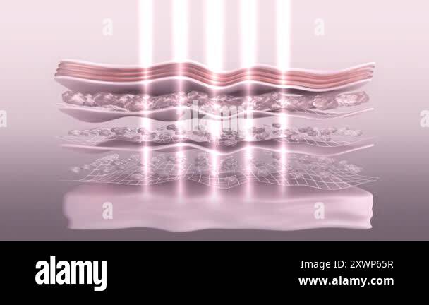 Laser skin collagen-boosting treatment. Stylized wrinkled skin layers ...