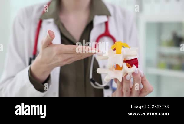 Doctor explains anatomy of human spine using model. Spinal hernia ...