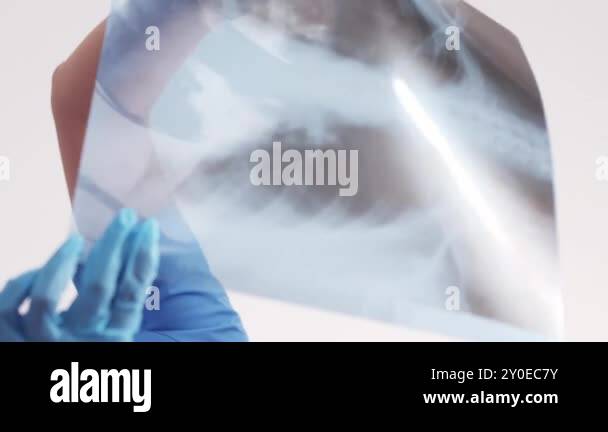 Vertical video. Medical diagnostics. Chest x-ray. Woman doctor studying ...