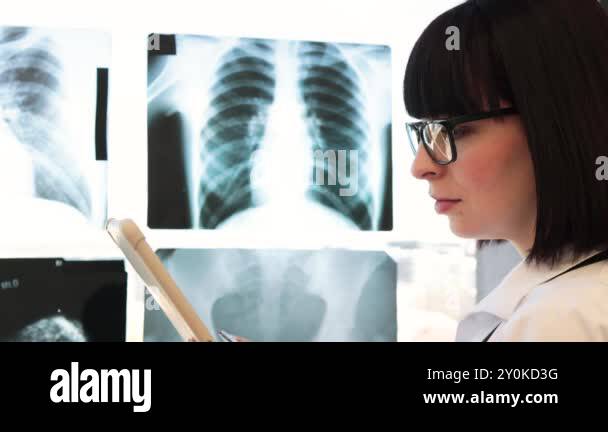 Doctor examining chest x-rays and mammograms in hospital setting ...
