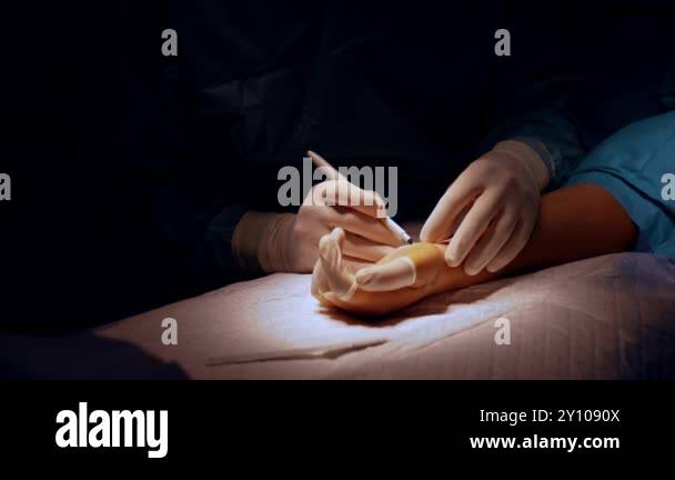 Surgery pen mark Stock Videos & Footage - HD and 4K Video Clips - Alamy