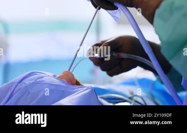 Doctor shoves surgical instrument into the patient's nasal cavity ...