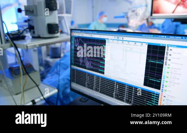 Computer screen depicting brain waves of a patient undergoing surgery ...