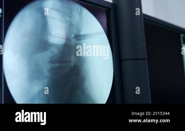 Body mri machines Stock Videos & Footage - HD and 4K Video Clips - Alamy
