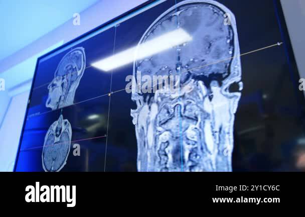 Brain scan mri x ray Stock Videos & Footage - HD and 4K Video Clips - Alamy