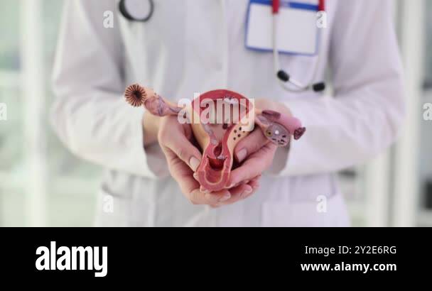 Gynecologist holds artificial model of uterus. Doctor gynecologist ...