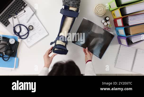 A patient with a leg fracture Stock Videos & Footage - HD and 4K Video ...