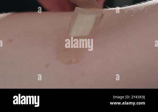 Moment a bandage is carefully peeled off human skin, showcasing the ...